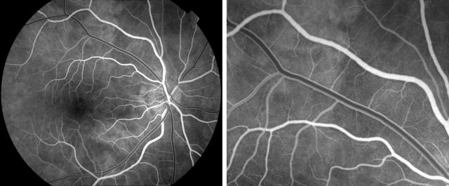 FA Interpretation | EYE-PIX