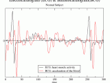 Ballistocardiogram