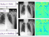 Conditional Diffusion Models As Medical Image Classifiers