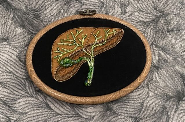 Finding Some New Awesome Art (or Still Celebrating My Liver) - Finding ...