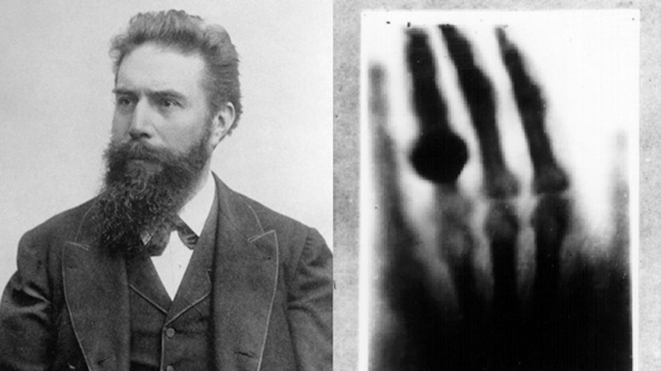 Bilim Tarihinde Bugün : Wilhelm Conrad Röntgen Doğdu