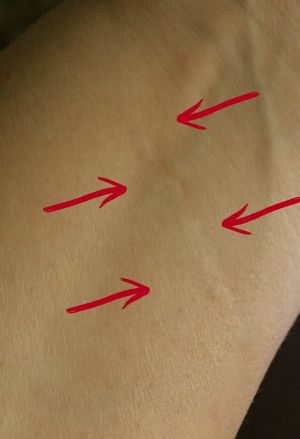 Do You Let Your Emotional Wounds Fester? | The Forgiven Wife