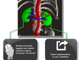 Interactive Segmentation For Oems In Radiology Via Imaging Sdks