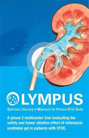 Investigational Therapy May Change How Urinary Tract Cancer is Treated ...