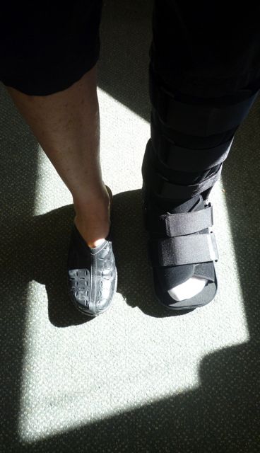 Achilles tendon surgery | Gimpy & Grumpy