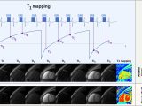 Github Cmrxrecon Cmrxrecon Code For The Cardiac Mri Reconstruction