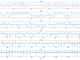 Github Nerajbobra Wavelet Based Ecg Compression Ecg Compression