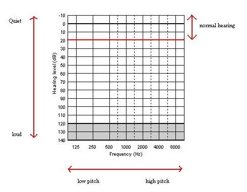 The Audiogram – A Brief History – The Official ReSound Blog