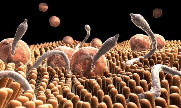 19 SIGNS YOU HAVE DANGEROUS INTERNAL PARASITES AND WHAT YOU NEED TO DO ...