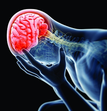 concussion 1 - Hands On Physical Therapy