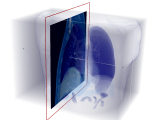 Medical Image Acquisition And Processing