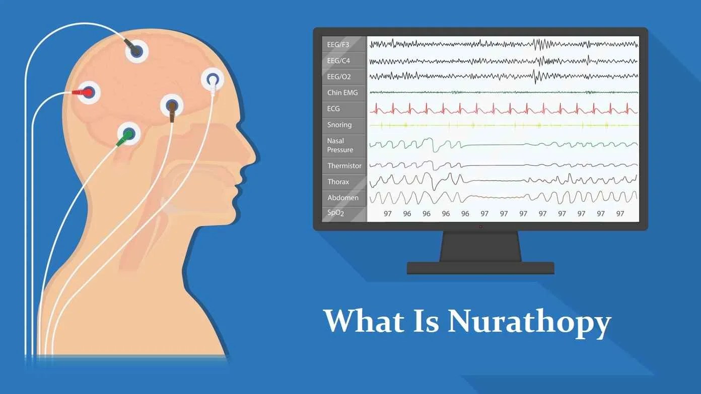 What Is Nurathopy? - Hesolite