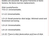 Mri Results Thoughts R Sciatica