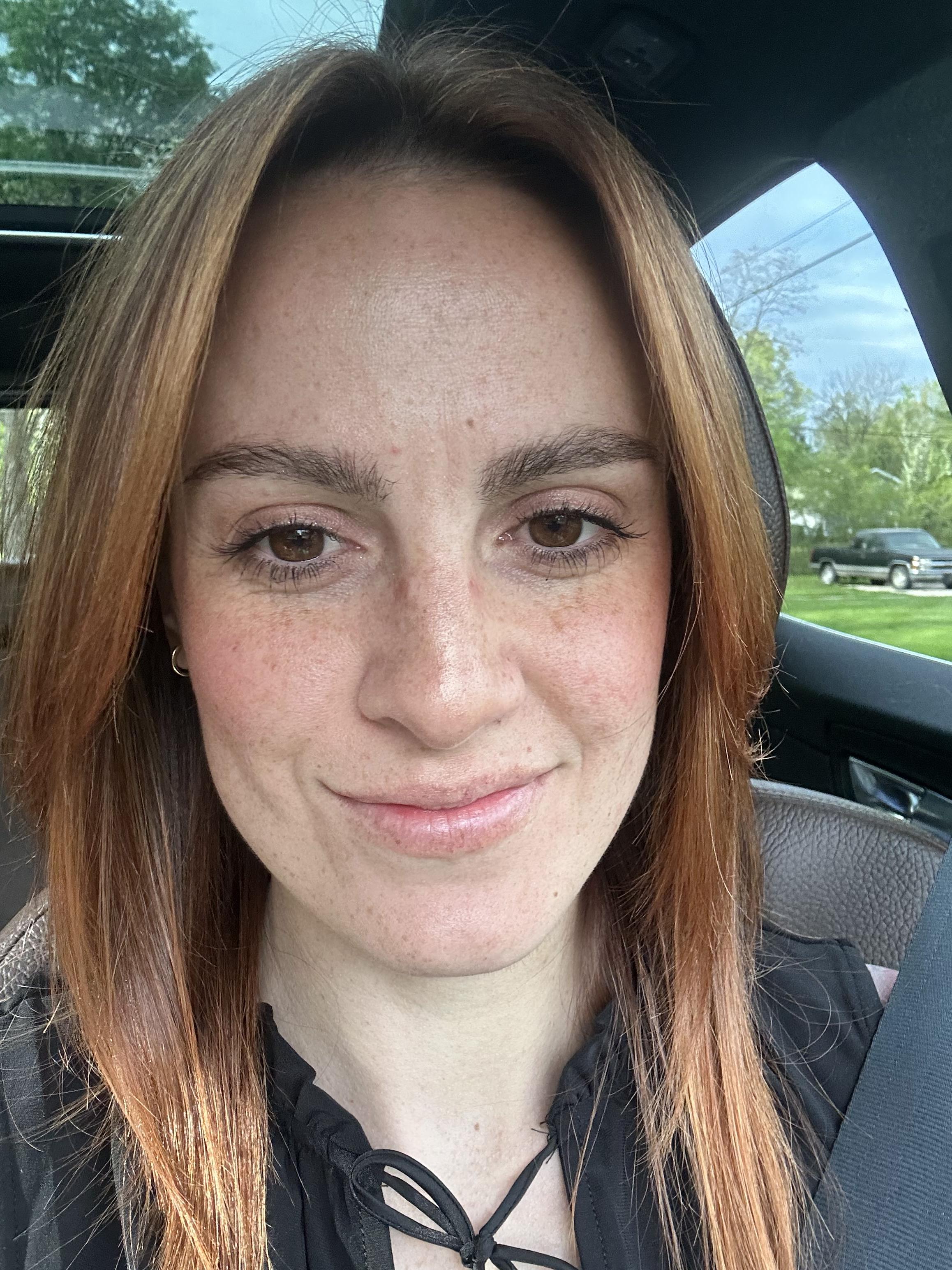 Embracing My Freckles Sexy Sexy