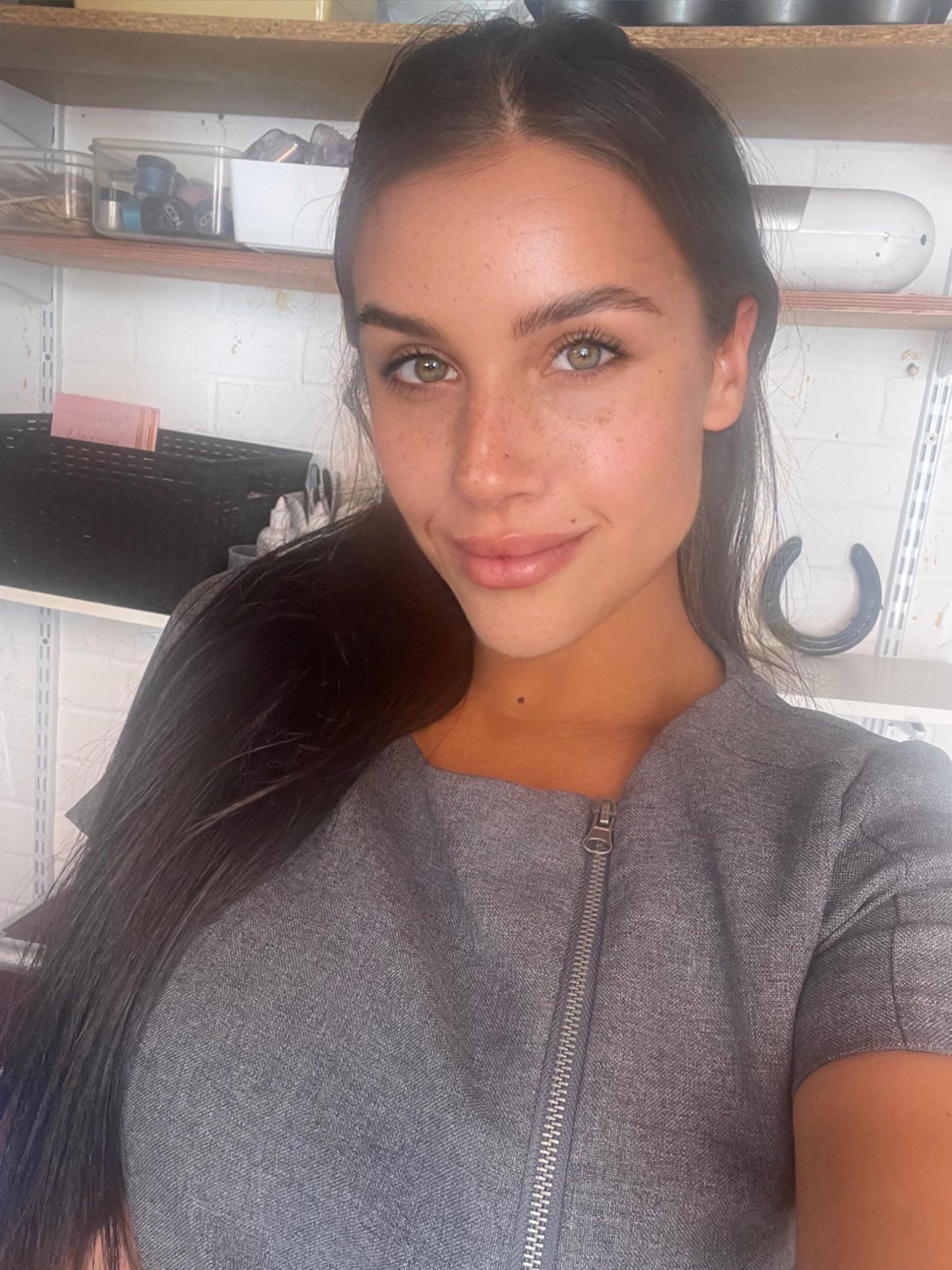 Are My Freckles Cute Or Ugly Sexy Sexy