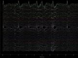 Python Add Labels To Real Time Signal Plotting With Vispy Stack