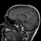 Python Reverse Colormap In Matplotlib Stack Overflow