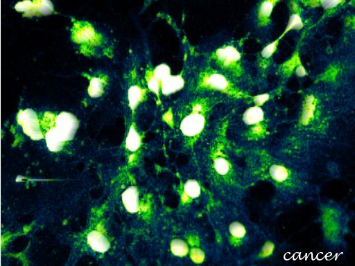 Multithreading Implements Runnable Vs Extends Thread In Java