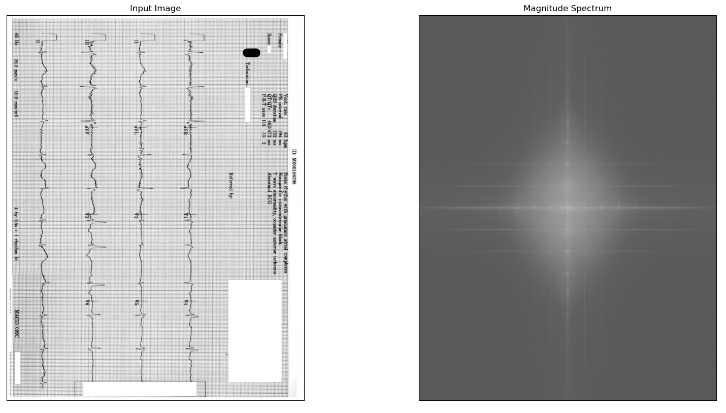 How To Remove Graph Lines From Cardiogram Image Enable OCR how-to-remove-graph-lines-from-cardiogram-image-enable-ocr