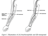 Human Anatomy Cross Section Through The Right Arm Question Biology