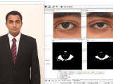 Python Eye Pupil Corner Detection Opencv Stack Overflow