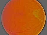 Illumination Normalization Using Python Opencv Stack Overflow