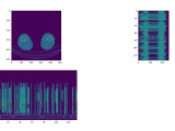 Slice Dicom Slicing Orders In Python Stack Overflow