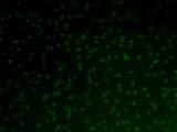 Python Counting Cells With Opencv Stack Overflow