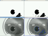 Pupil Detection In Opencv Python Stack Overflow