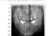 Numpy Panoramic X Ray Normalization In Python Stack Overflow