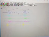 Microcontroller Adc Hex Equivalent And Display Electrical Engineering