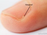 Word Usage Is It Correct To Say Don T Pull Out Your Hangnail Dead