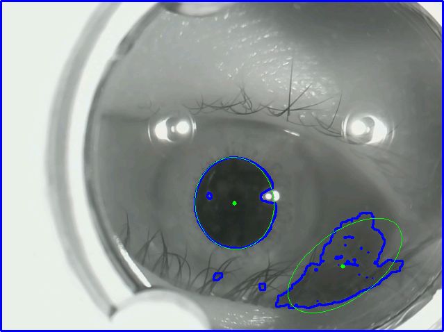 Python Opencv Detecting Eye Pupil Middle Stack Overflow - Mobile Abstract Illustrations for Desktop