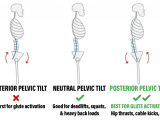 Weightlifting Why Is Said To Be Safe To Posteriorly Tilt The Pelvis