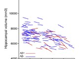 R Plot Longitudinal Data Per Subject Stack Overflow