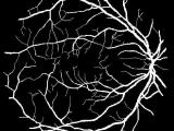 Remove The Background Of An Object In Image Using Matlab Stack Overflow