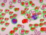 Python Count Number Of Cells In The Image Stack Overflow