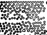 How To Count Objects In Image Using Python Stack Overflow
