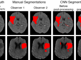 Github Sangh0 Segmentation Image Segmentation Paper Review And