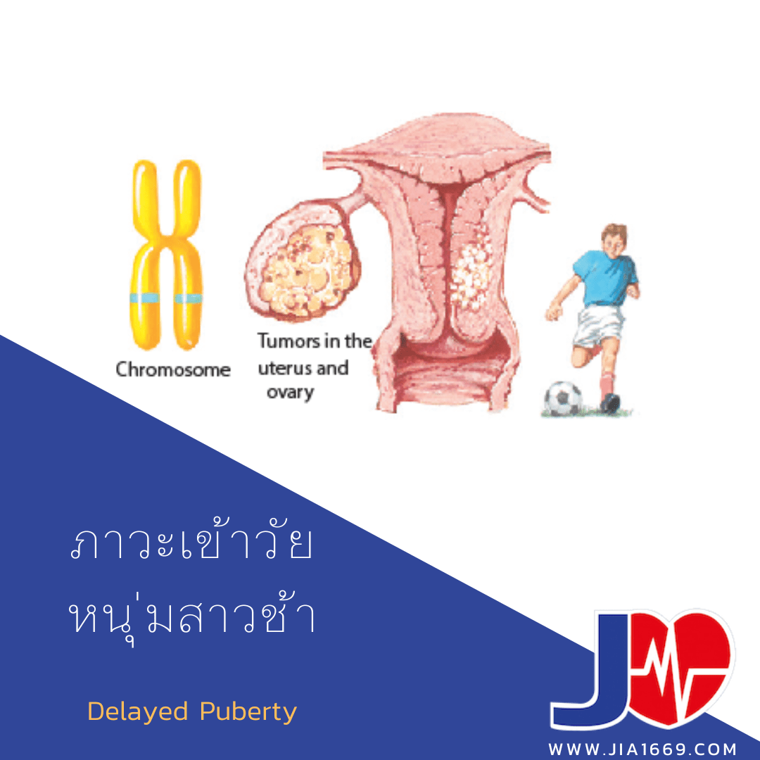 Delayed Puberty
