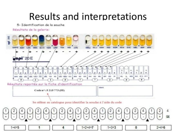 Api 20e Identification Table Brokeasshome Api 20e Identification Table Brokeasshome