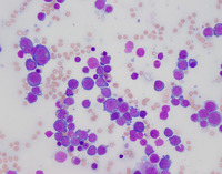 Bone Marrow Smear Labeled
