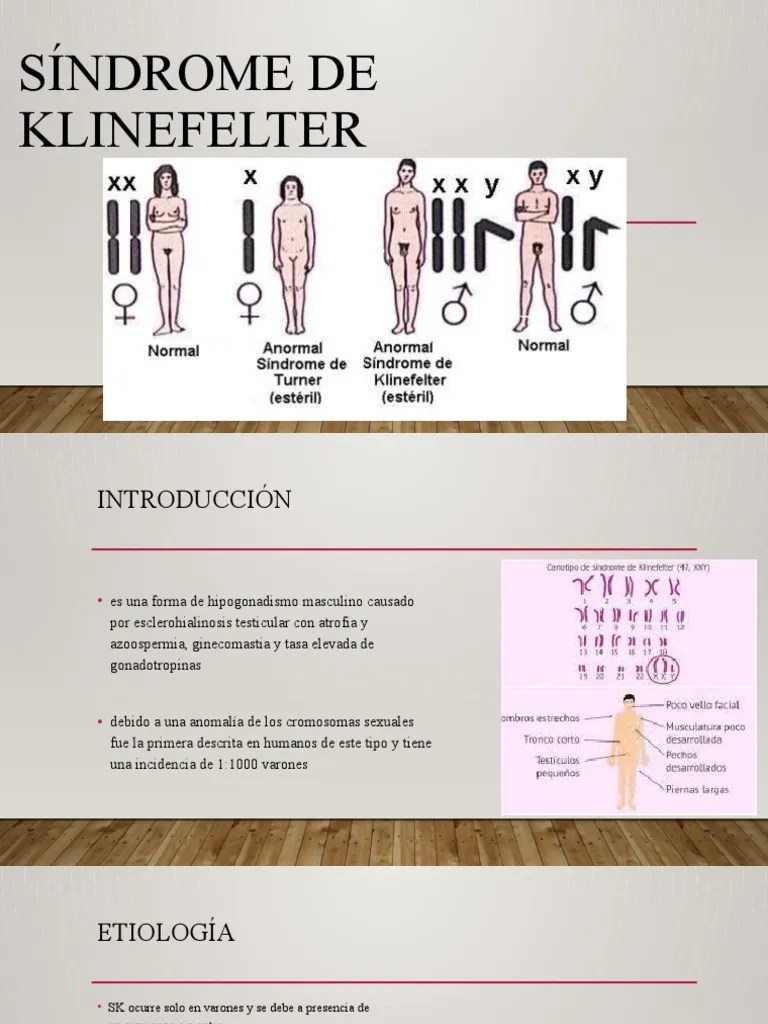 Síndrome De Klinefelter Características Y Diagnóstico Pdf
