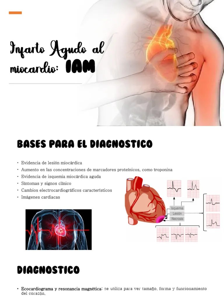 Iam Pdf Infarto De Miocardio Corazón