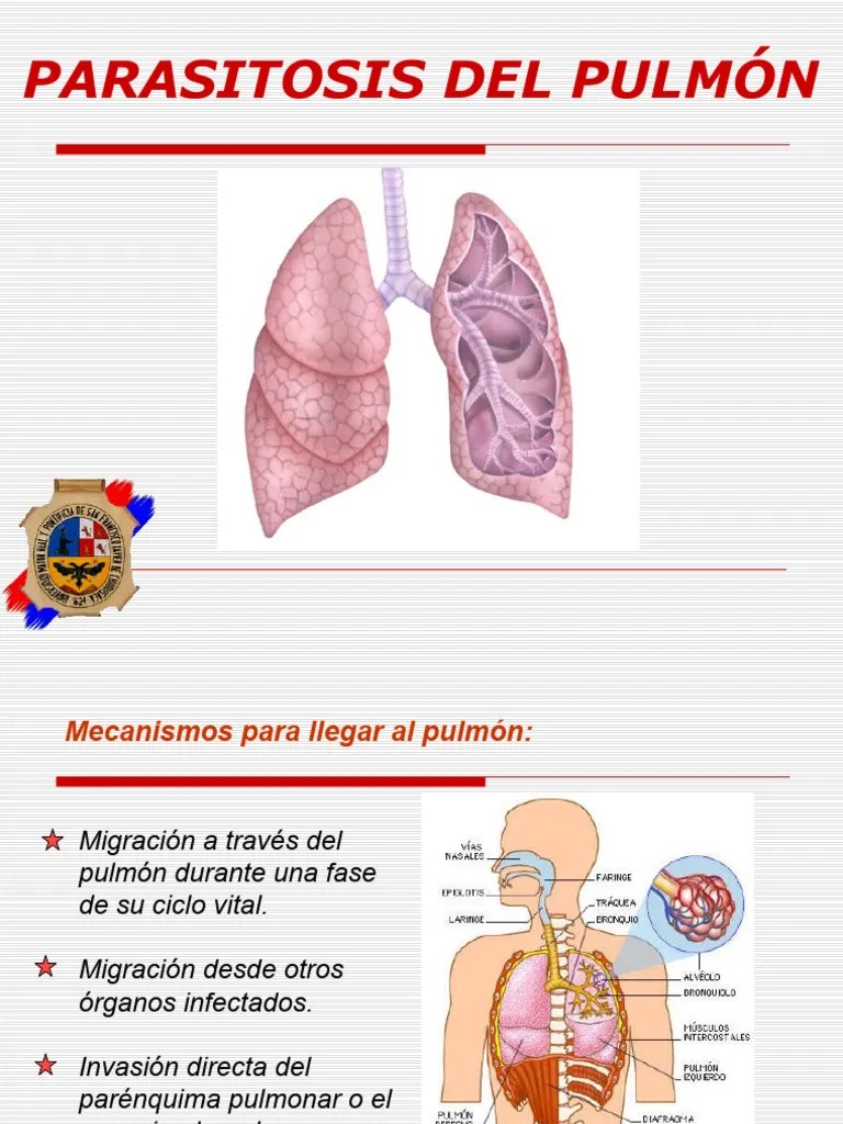 Parasitología Pulmonar Tipos Y Síntomas Pdf Tos Pulmón
