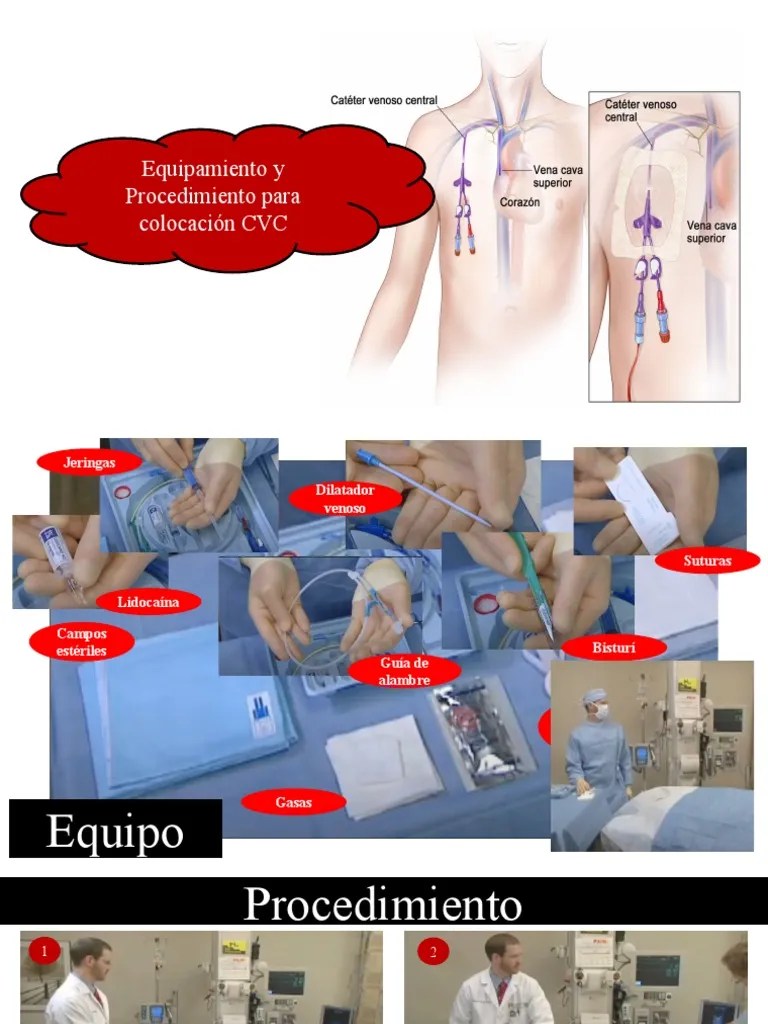 Equipamiento Y Procedimiento Para Colocación Cvc Pdf