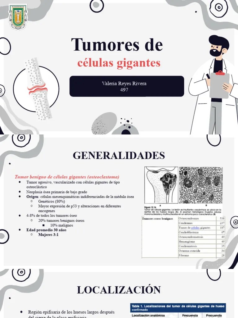 Tumores De Células Gigantes Diagnóstico Y Tratamiento Pdf