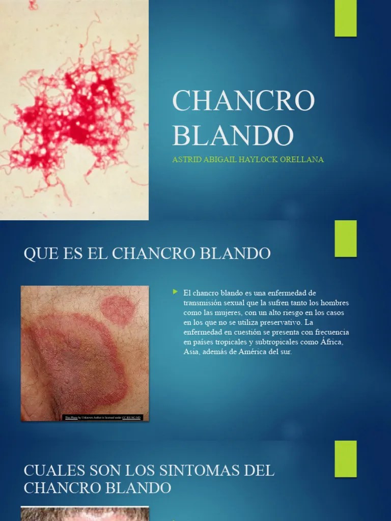 Chancro Blando Síntomas Y Prevención Pdf Infección Transmitida