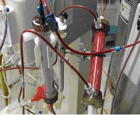 Selective Cytopheretic Device – Innovative BioTherapies, Inc.