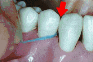 What That Mouth (Won't) Do | inside jamari fox